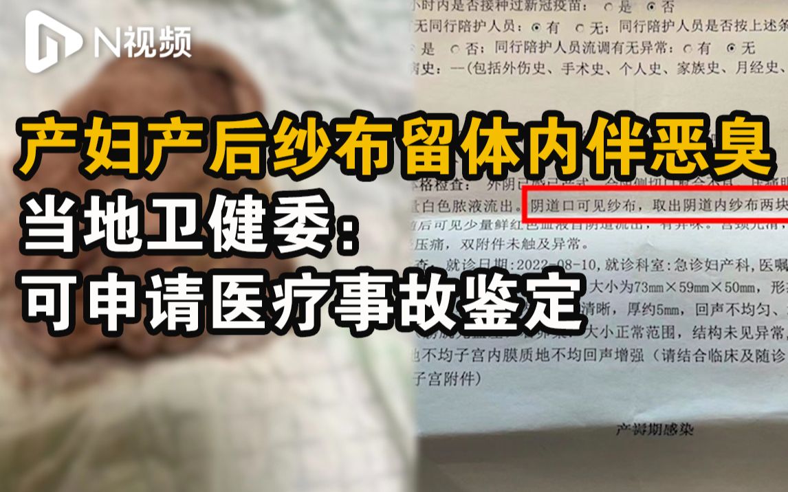 江苏女子产后纱布遗留体内,当地卫健委:可申请医疗事故鉴定