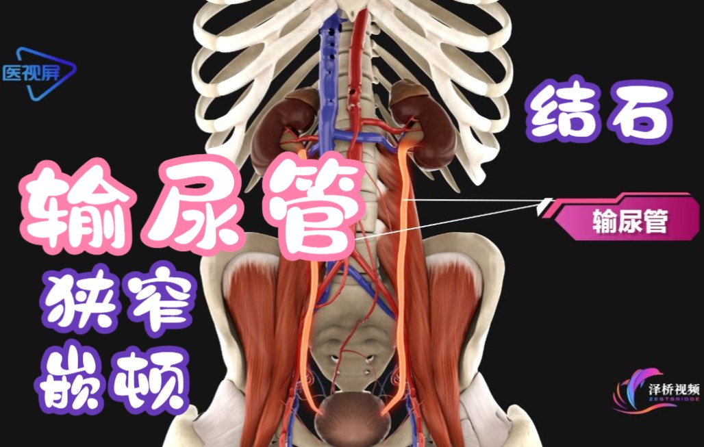 【系统解剖】--输尿管,肾结石易嵌顿的部位