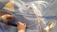 胸腔 3 穿刺置管 Ultrasound Guided Chest Tube