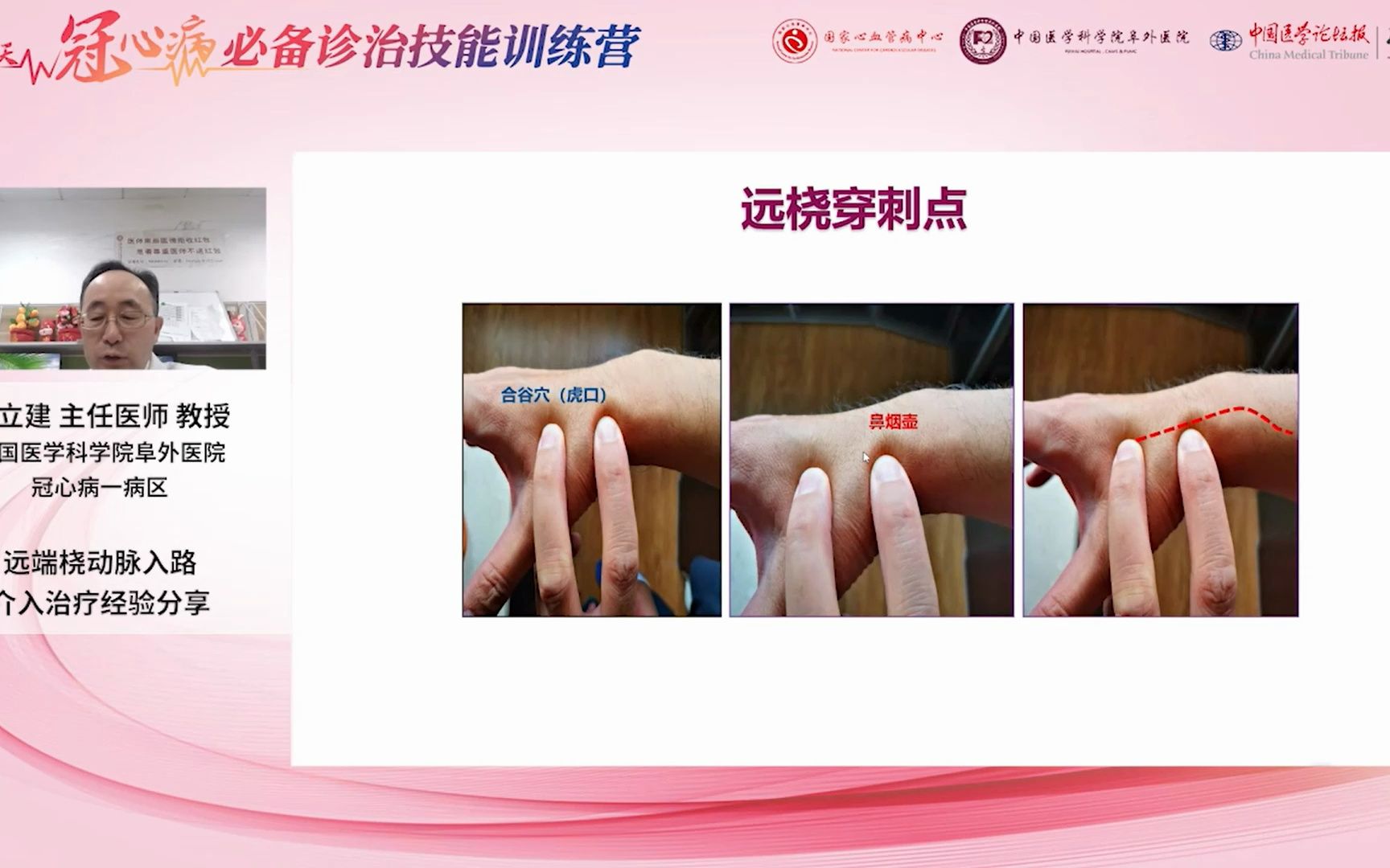9 远端桡动脉入路介入治疗经验分享