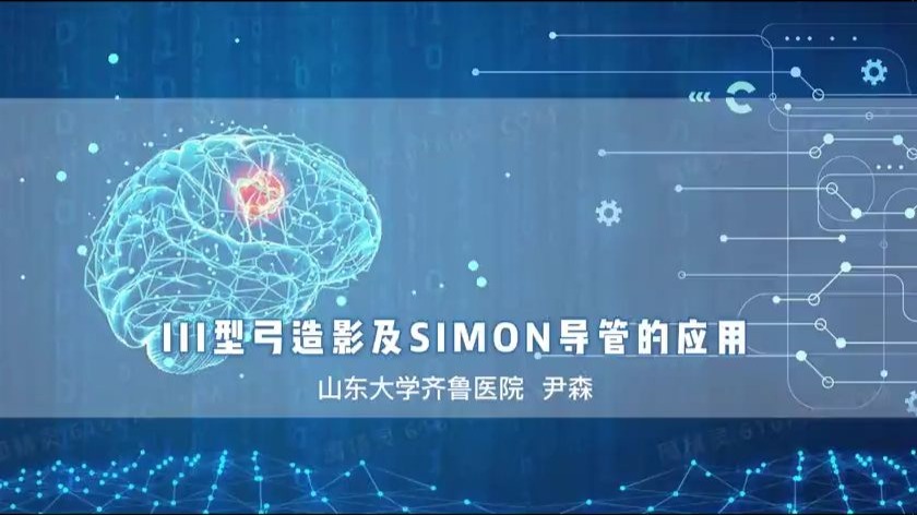 1.III型弓造影及SIMON导管的应用