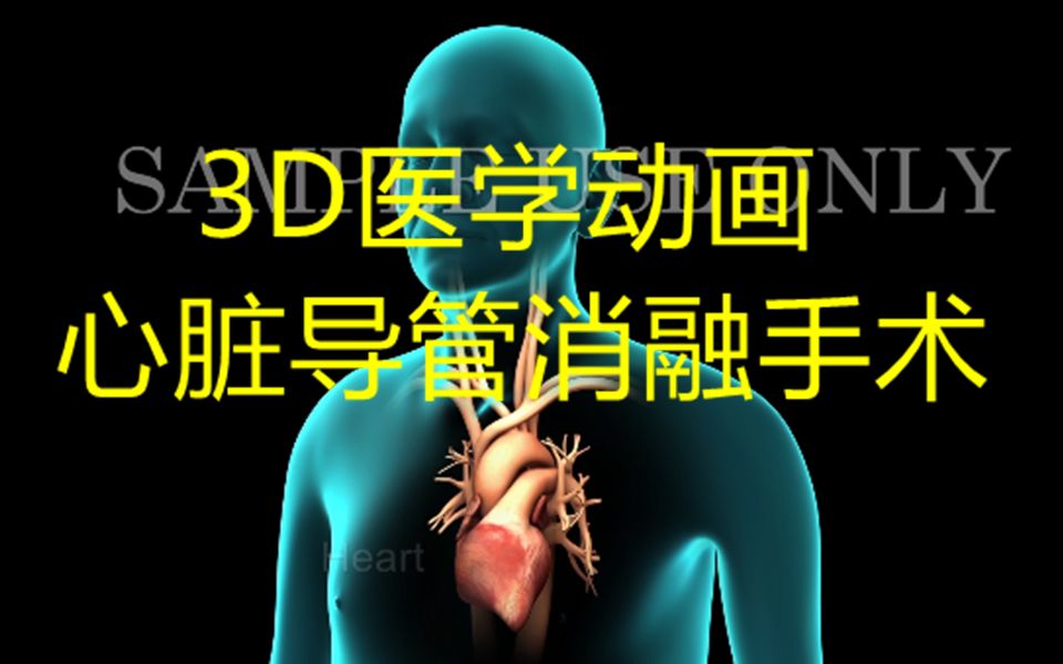 对于某些类型的心律失常,可能需要进行导管消融手术以阻止心脏组织...