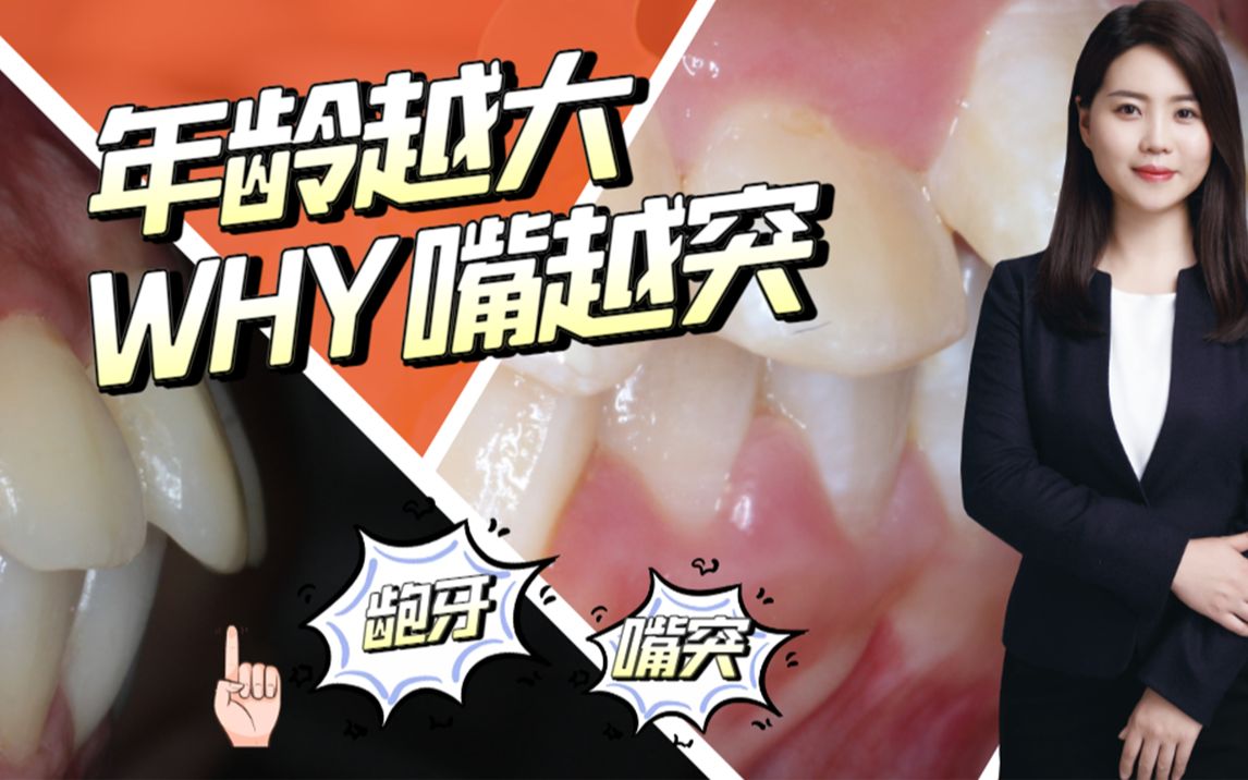 为什么随着年龄的增长,嘴巴会越来越突?