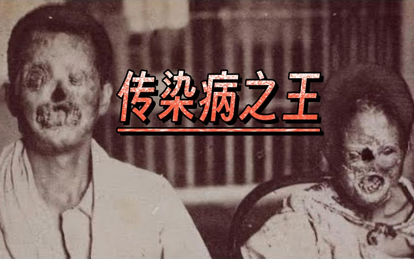 这种疾病杀死了数十亿人,患病的人都死的很惨