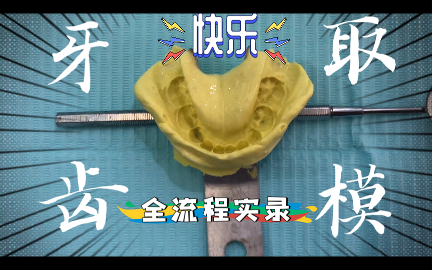 「正畸」取模不易,全靠演技!