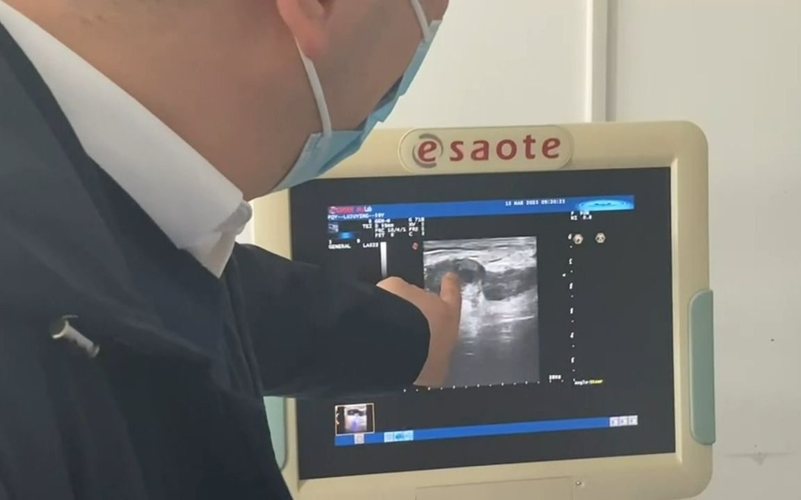 [教学Tips]B超引导下假性动脉瘤凝血酶注射闭合注意事项