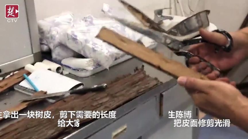 50年前的杉树皮变身土味小夹板,“绝版”疗法为八旬婆婆成功接骨