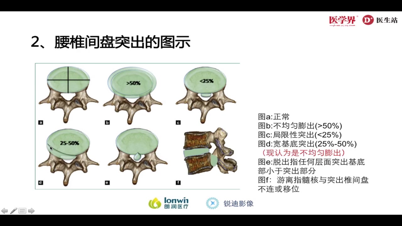 腰椎间盘突出神经根压迫CT_MR解析