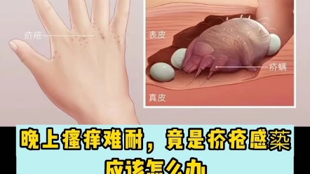 【皮肤科戴主任】天气变热起来了,很多皮肤病也会变得高发。今天...