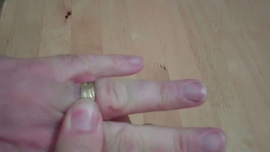 一根鱼线帮你取下卡在手指上的戒指!