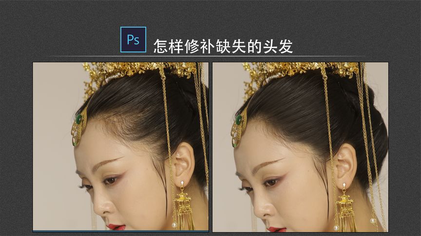 PS修补发际线稀缺的头发