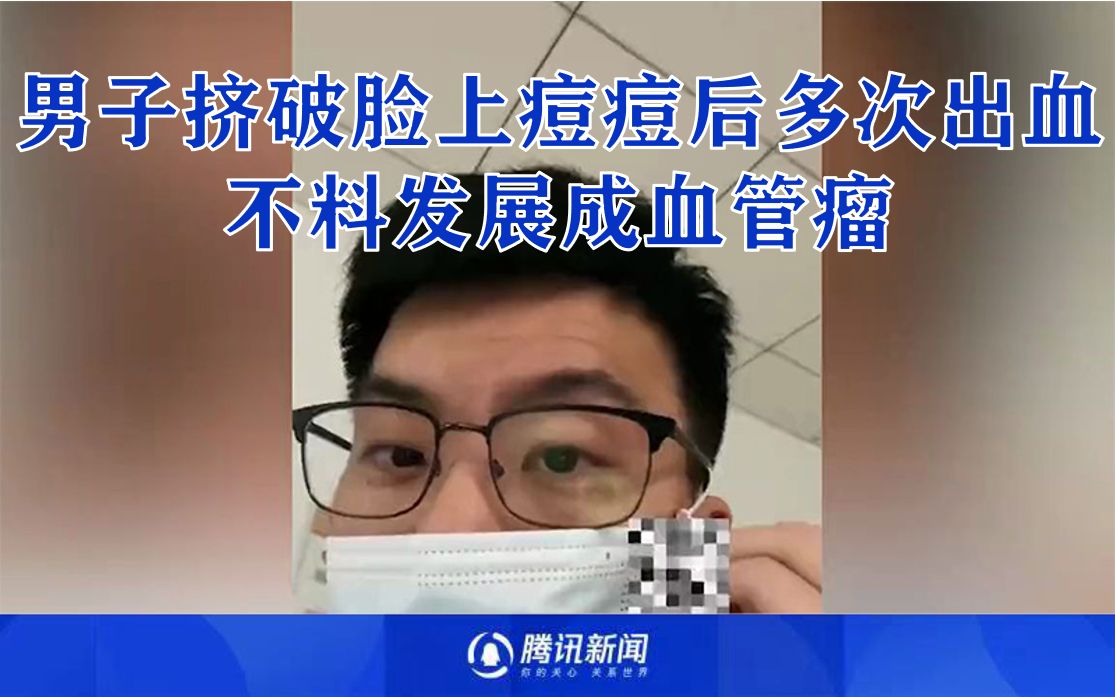 男子挤破痘凝成血痂,又挑破血流不止,不料发展成血管瘤