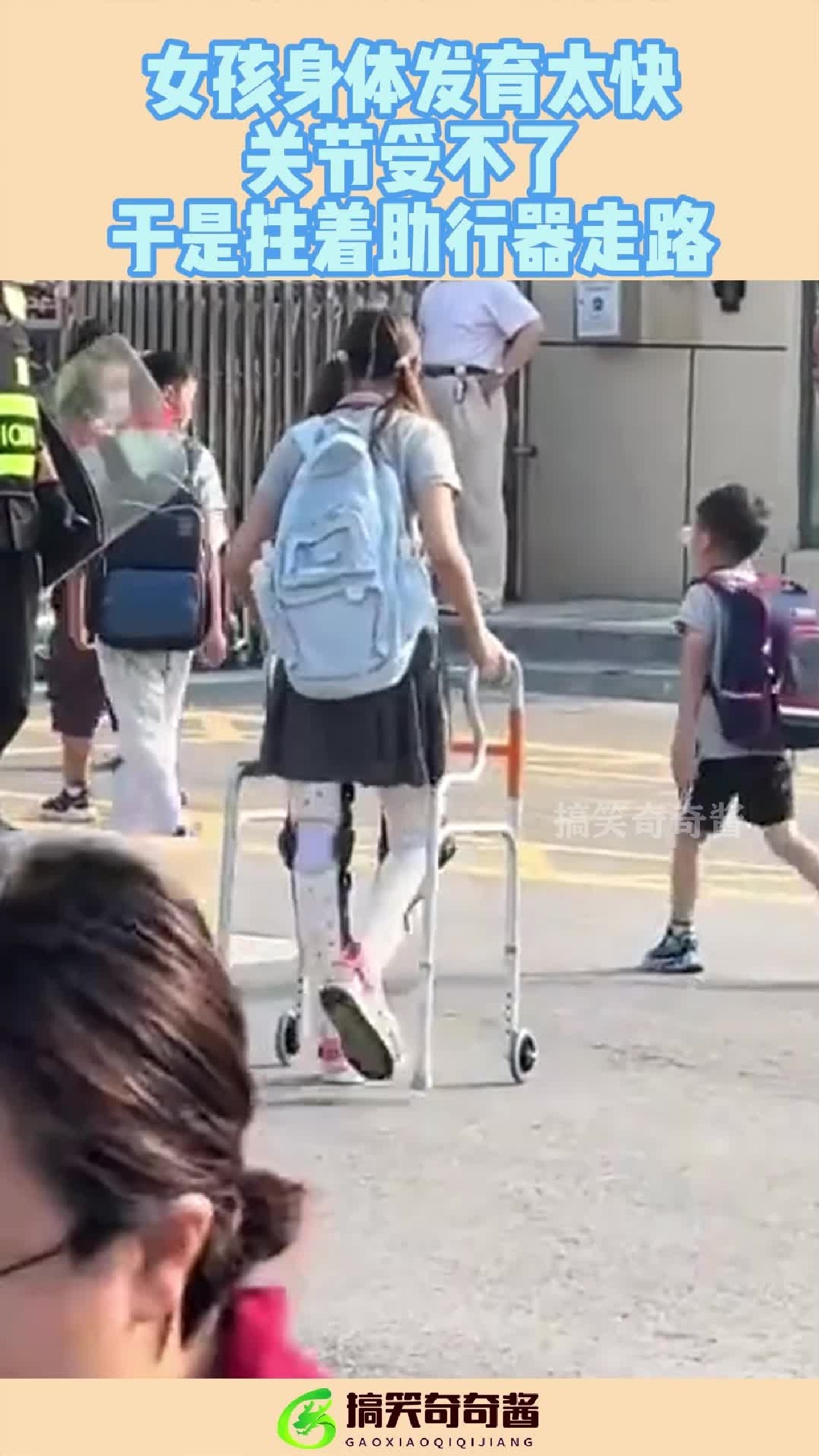 女孩身体发育太快,关节受不了,于是拄着助行器走路!