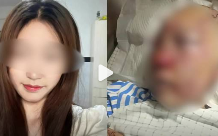 女子在公厕内遭男子殴打:初步鉴定轻伤二级以上,打人者被逮捕