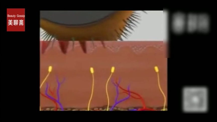 “痘坑救星”微针究竟是如何在皮肤上起作用的?