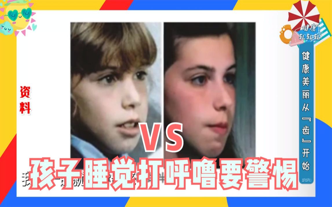 别以为孩子打呼噜睡得香!腺样体肥大,口呼吸影响颜值和智力!