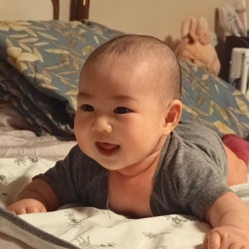 瓜条TIA 