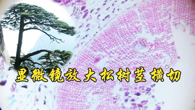 松树茎横切显微镜下放大400倍,画面太有美感,美如石榴果实