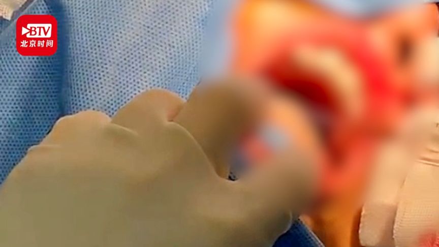 咬主人的狗咋办?辽宁一女子被自家大狗扑倒咬掉嘴唇