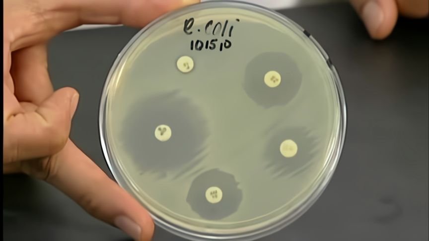 纸片扩散法测定细菌药敏试验步骤