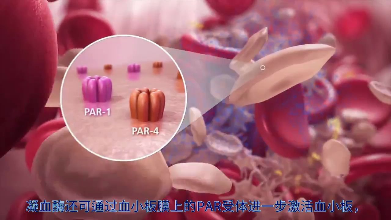 外周动脉疾病简介—中文配音版