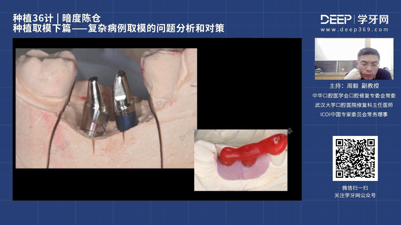 09.暗度陈仓:种植取模下篇 - 复杂病例取模的问题分析和对策