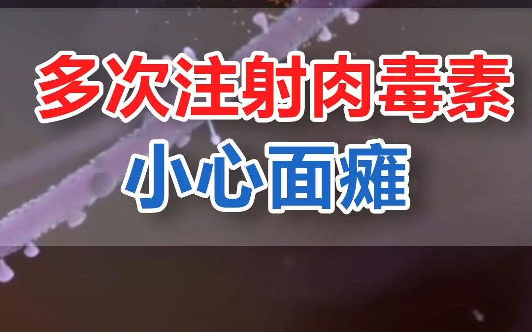 多次注射肉毒素 小心面瘫