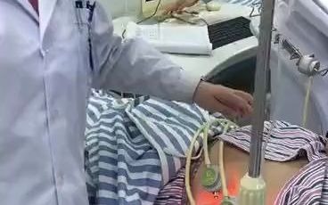 医生为面部白癜风患者提取正常皮肤进行黑色素培植手术