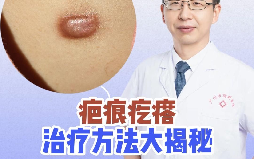 疤痕疙瘩治疗方法大揭秘