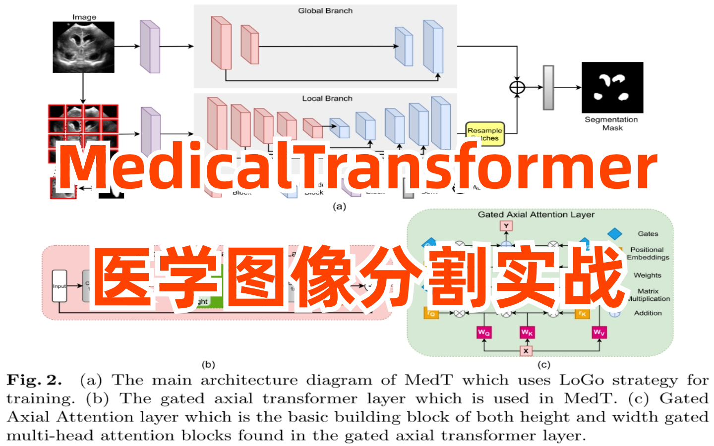 ...用于医学图像分割的MedicalTransformer 论文精读+代码讲解,太透彻...