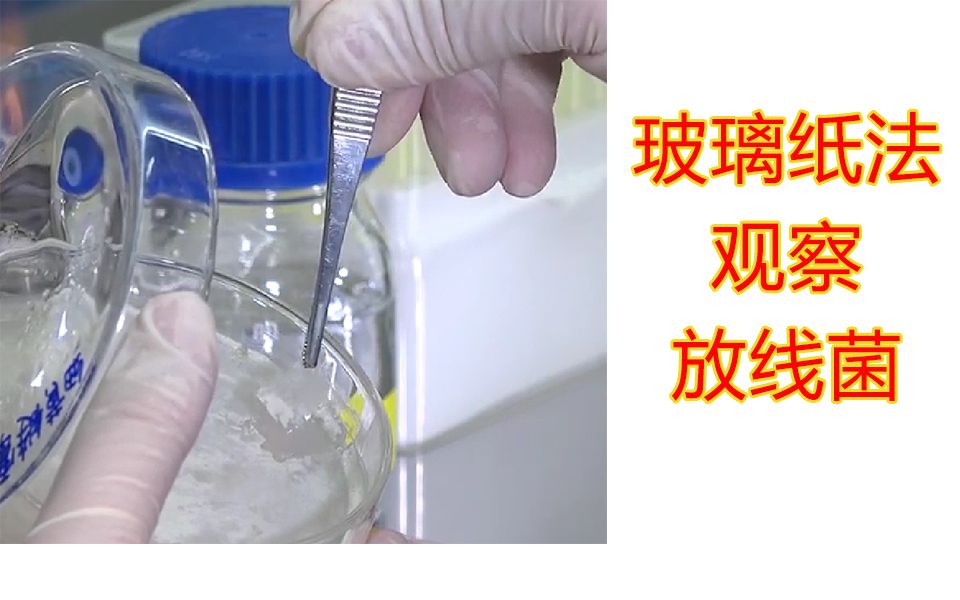 【实验】玻璃纸法显微镜观察放线菌的形态