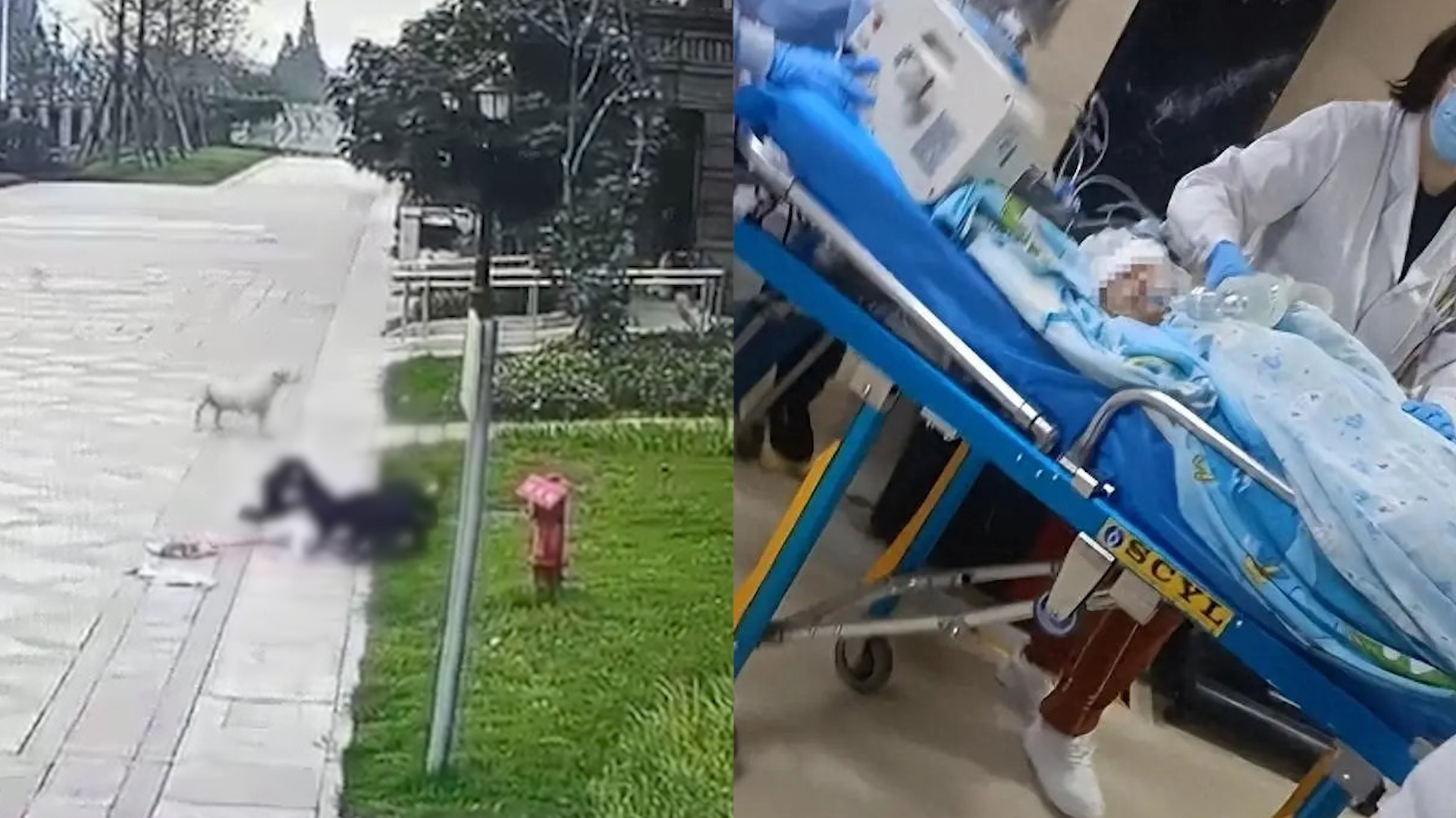 被狗咬伤女童仍昏迷有摘肾可能,母亲崩溃:狗主人方至今没道歉