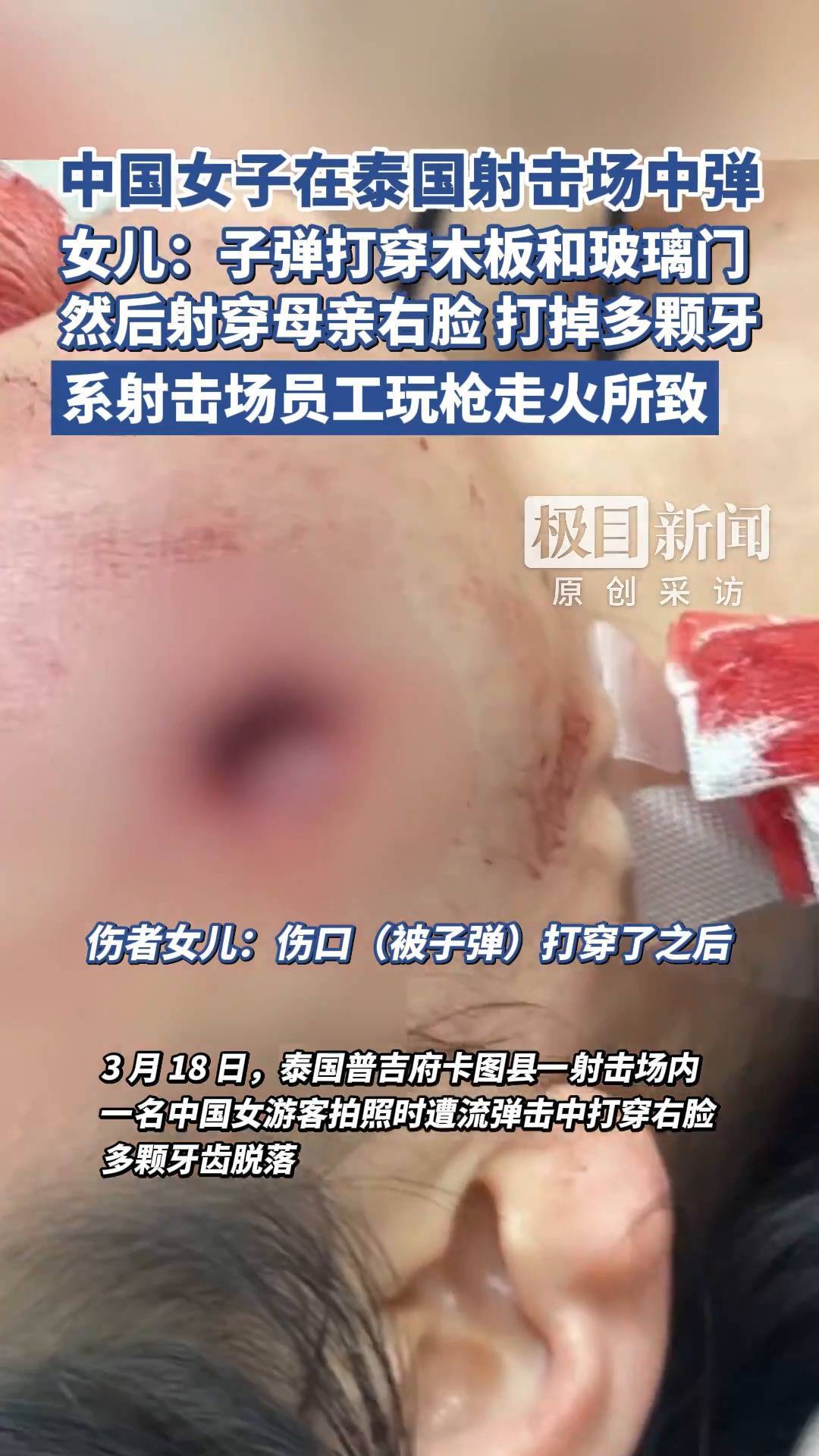 中国女子在泰国射击场中弹,女儿:子弹打穿木板和玻璃门,然后射穿母亲右脸,打掉多颗牙,系射击场员工玩枪走火所致