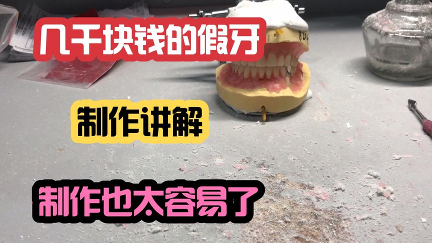 几千块钱的活动假牙制作讲解,家建制作的也太容易了
