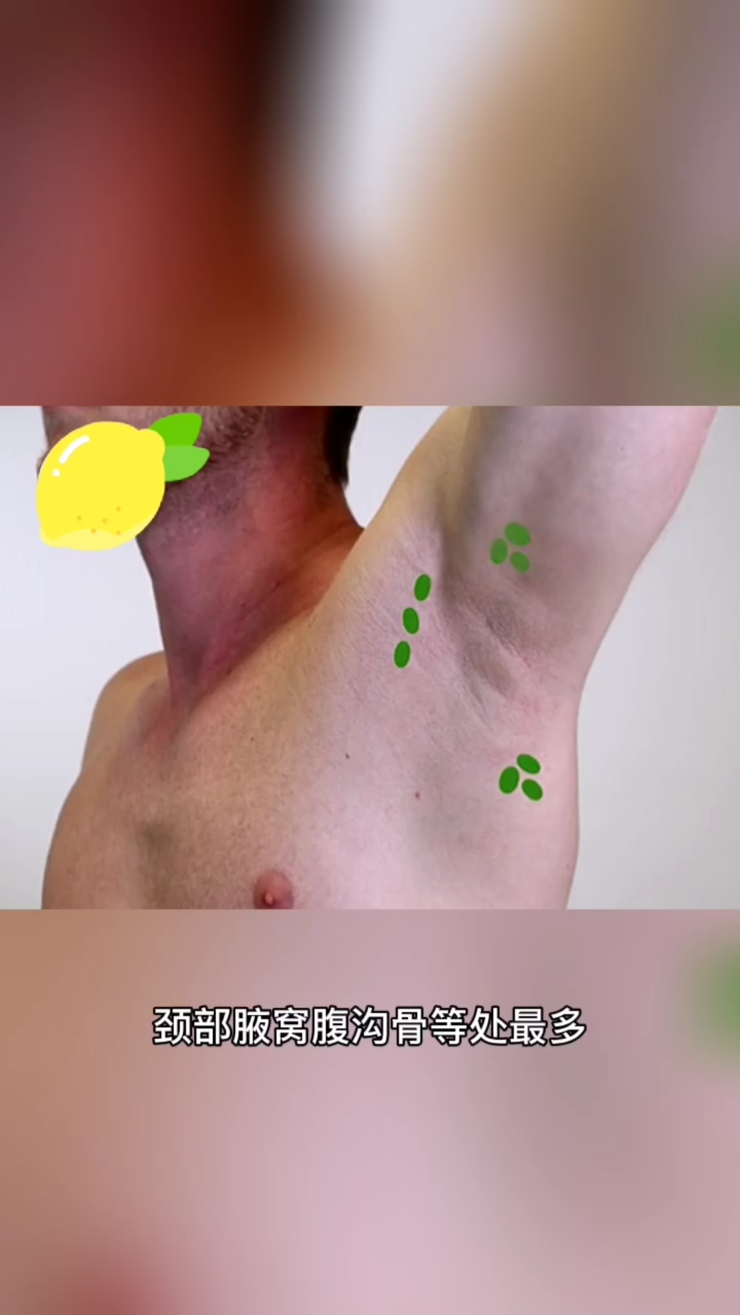 淋巴结,很多人认为是可怕的器官,其实它关