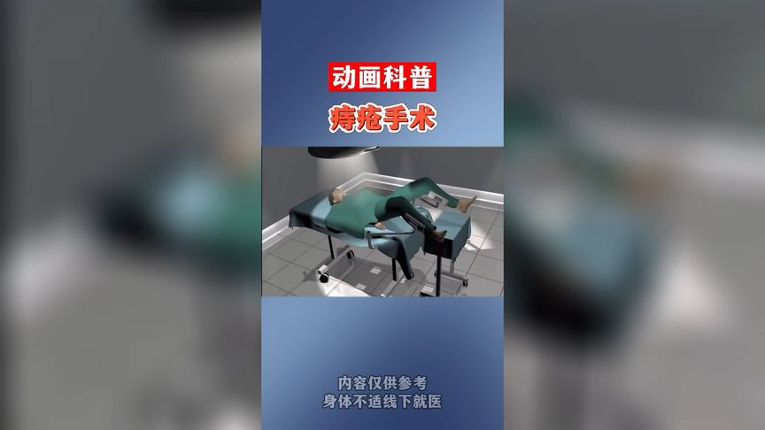动画科普:痔疮手术 (2)