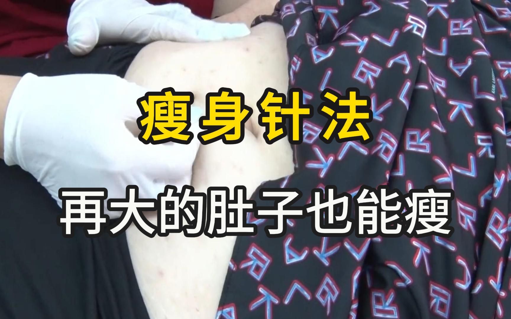 汉传针雕-王瑞雪 瘦身针法 拥有好身材 美容针法教学