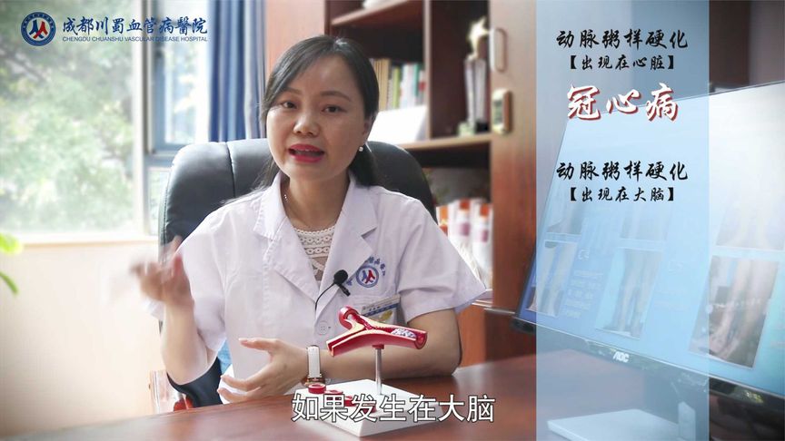 下肢动脉硬化形成.mp4