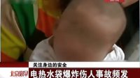 关注身边的安全:电热水袋爆炸伤人事故频发[北京您早]