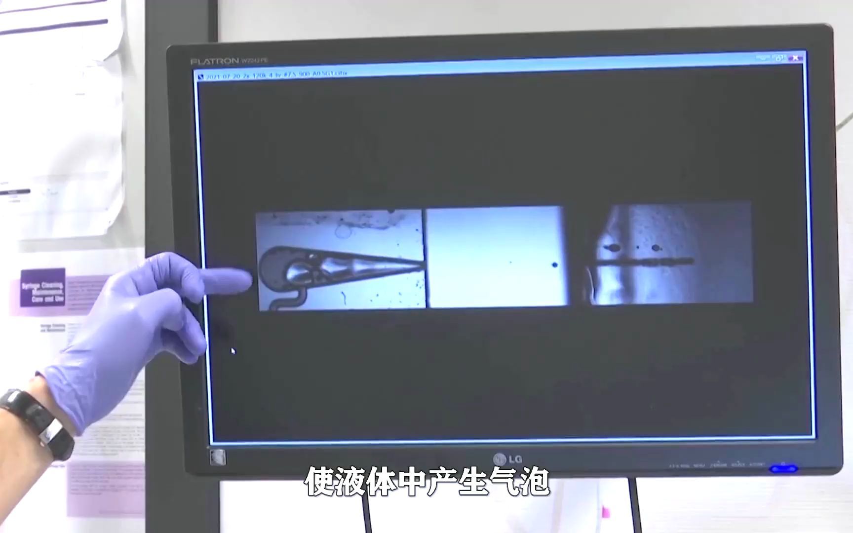 没有针头的注射器,利用激光将药剂推进皮肤,你知道原理吗?