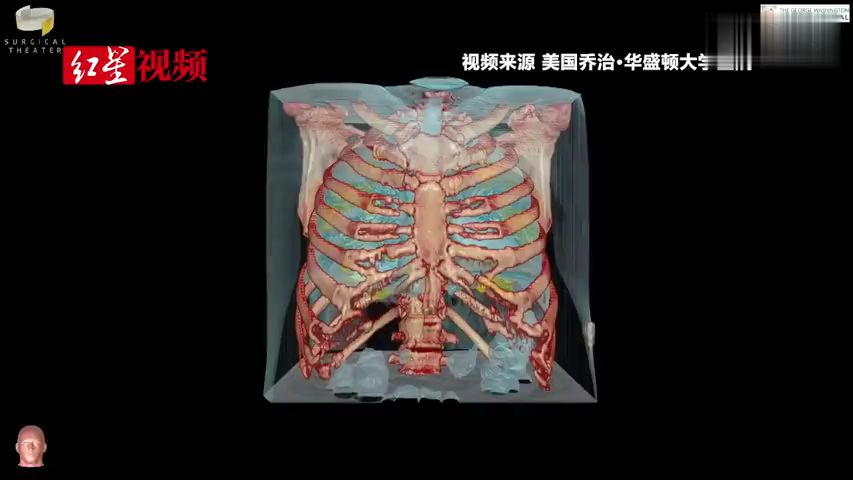 美国3d动画演示新冠病肺炎感染过程