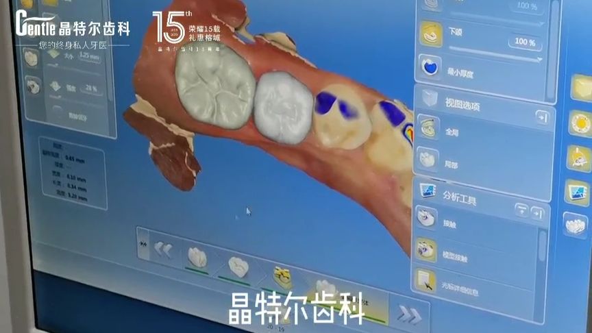 数字化口腔设备ߑ�舒适化诊疗更进一步