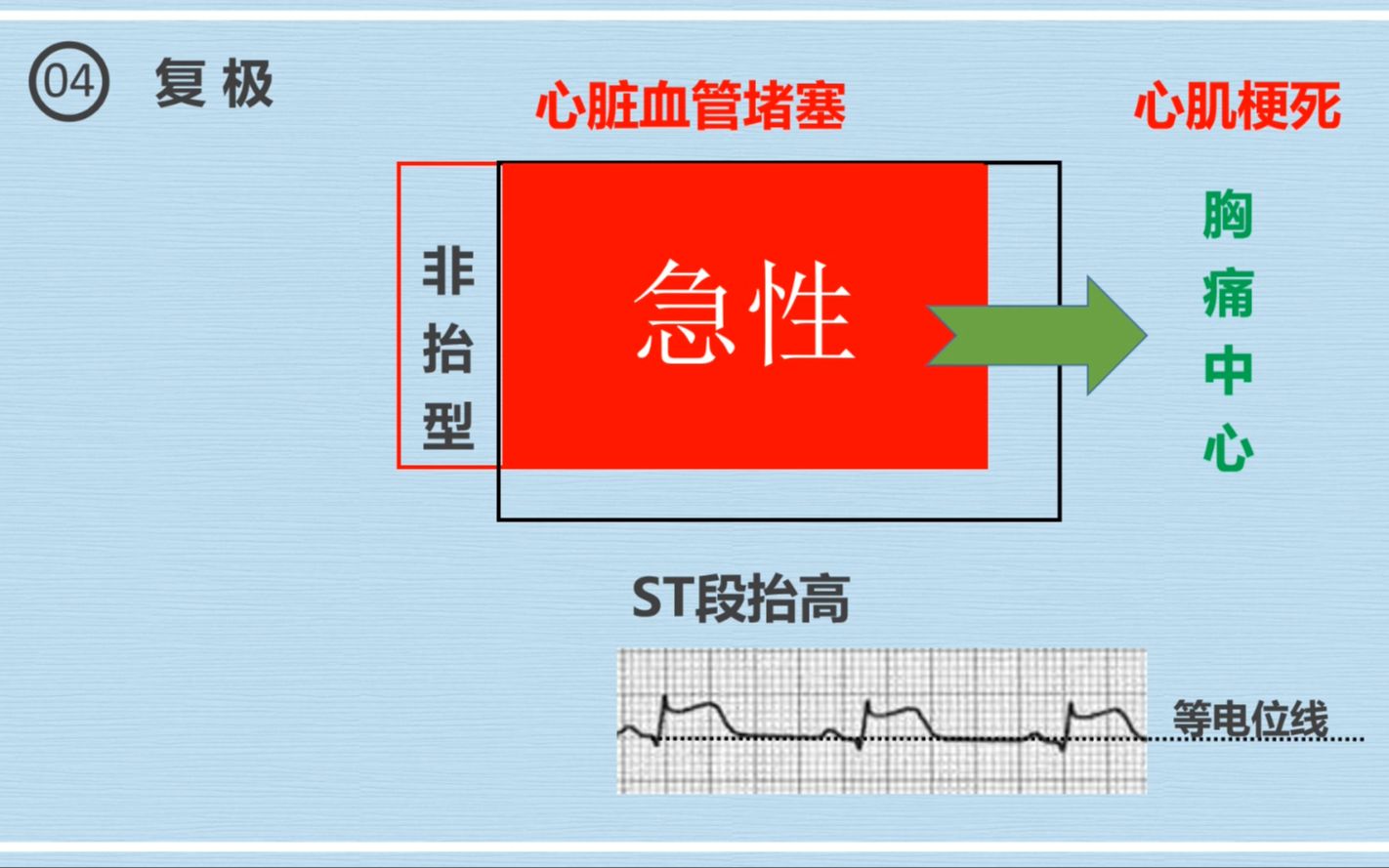 【心电图该怎么看】07.冠心病的警钟:ST段