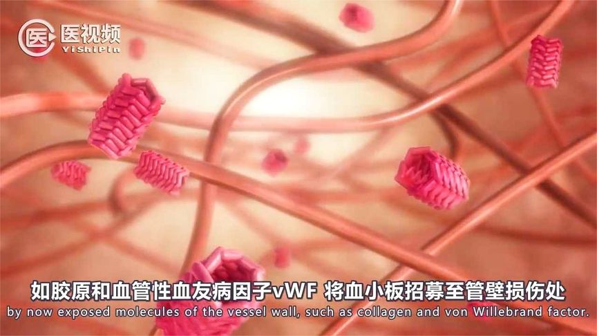一个动画搞懂血栓