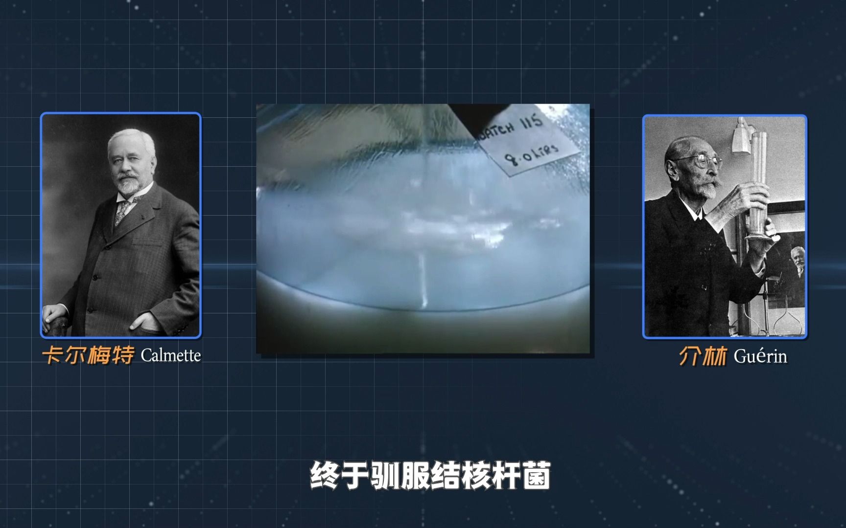 新生儿第一针疫苗——卡介苗