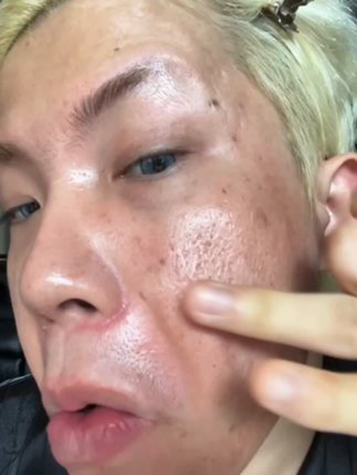 瑕疵皮大毛孔痘坑星人看过来!超简单柔焦磨皮法! #瑕疵皮 #原相机 #...