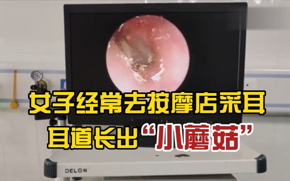 采耳危险!女子经常去按摩店采耳,耳道长“蘑菇”状真菌