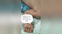 弗络尔水疗机调理儿童脓毒症