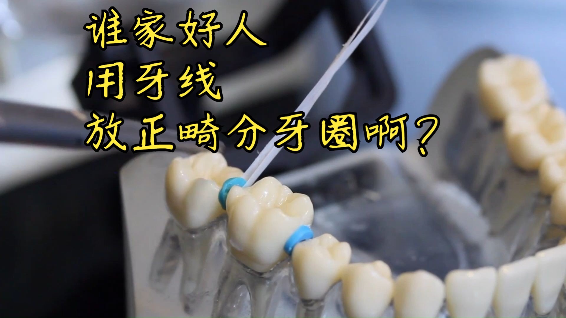 用牙线放正畸分牙圈的2种方法