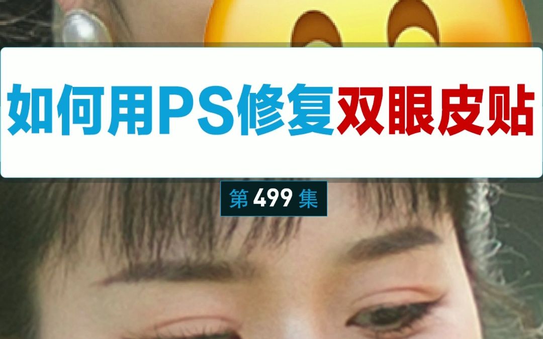 如何用ps修复双眼皮贴